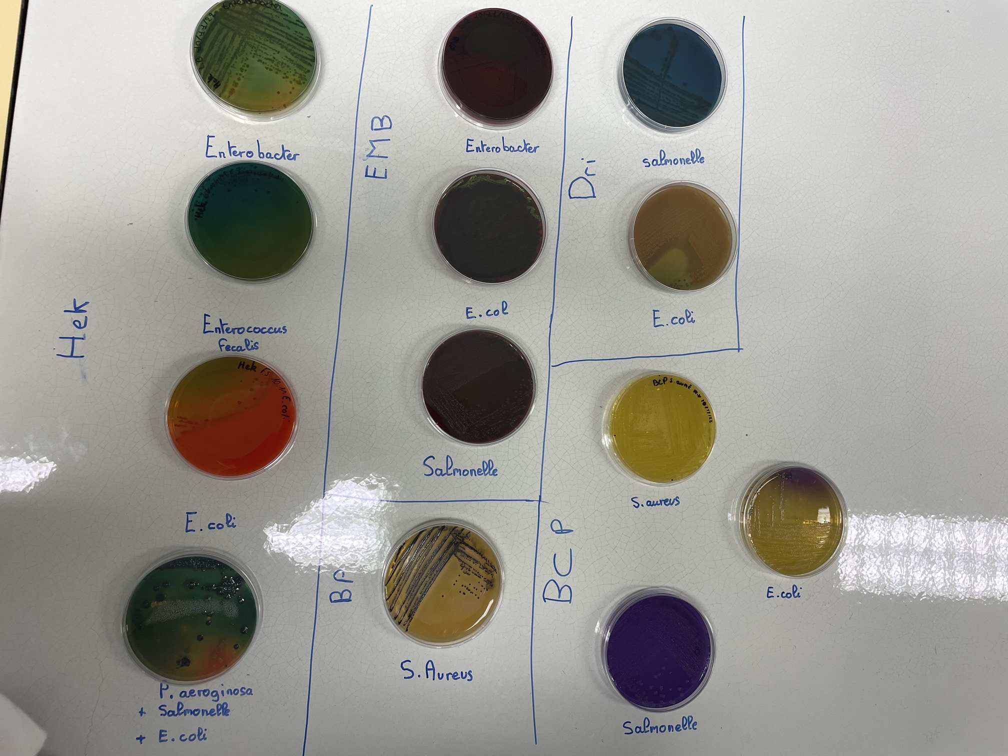 TP Découverte de milieux de culture sélectifs pour les 1ères LCQ - ISVT ...